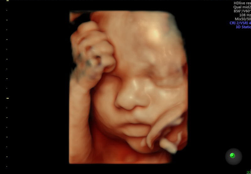 How Do Babies Sleep in the Womb? – Milkoholic Baby